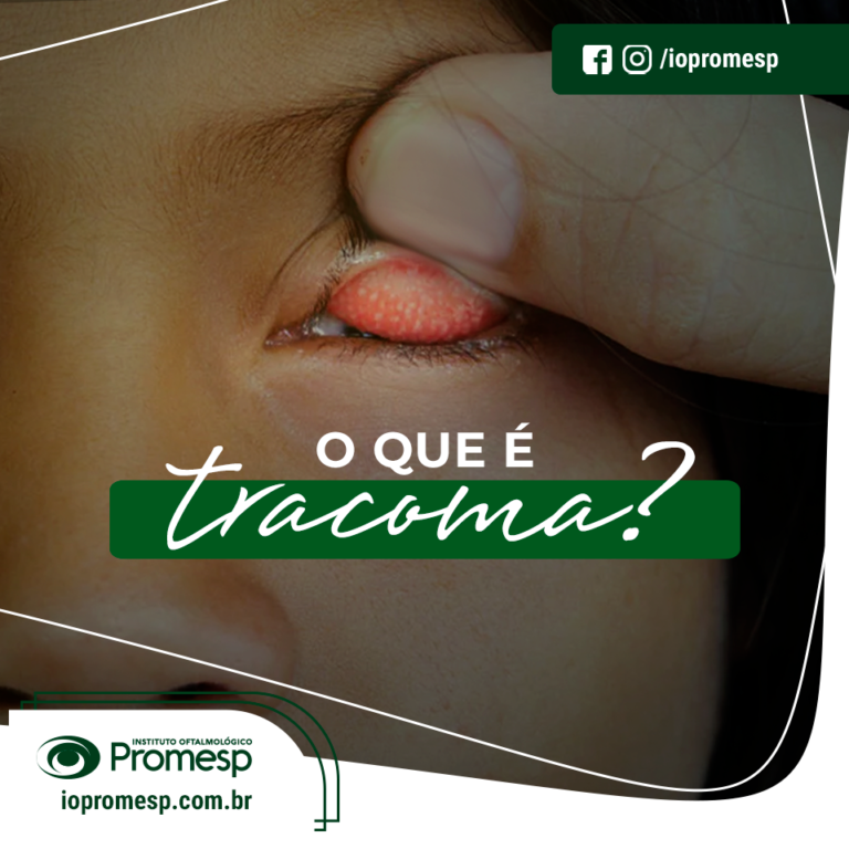 Instituto Oftalmológico PROMESP
