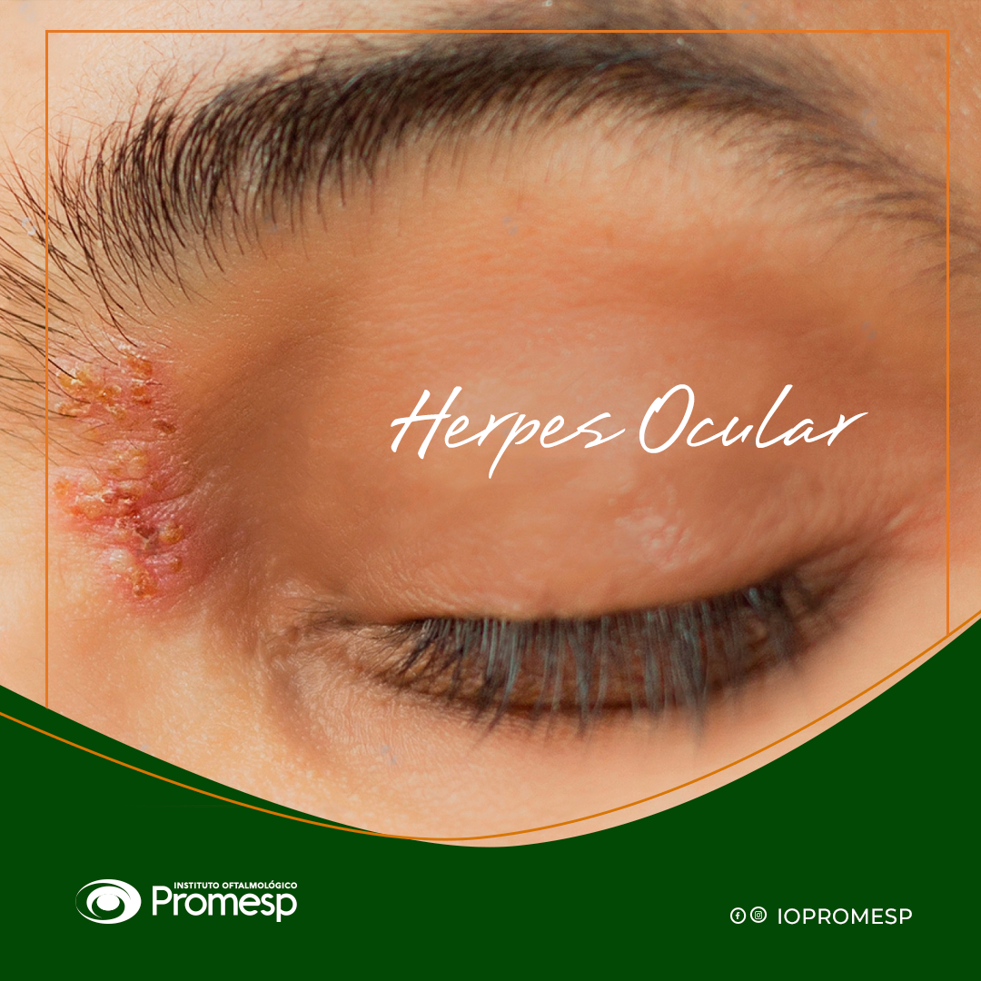 Instituto Oftalmológico PROMESP